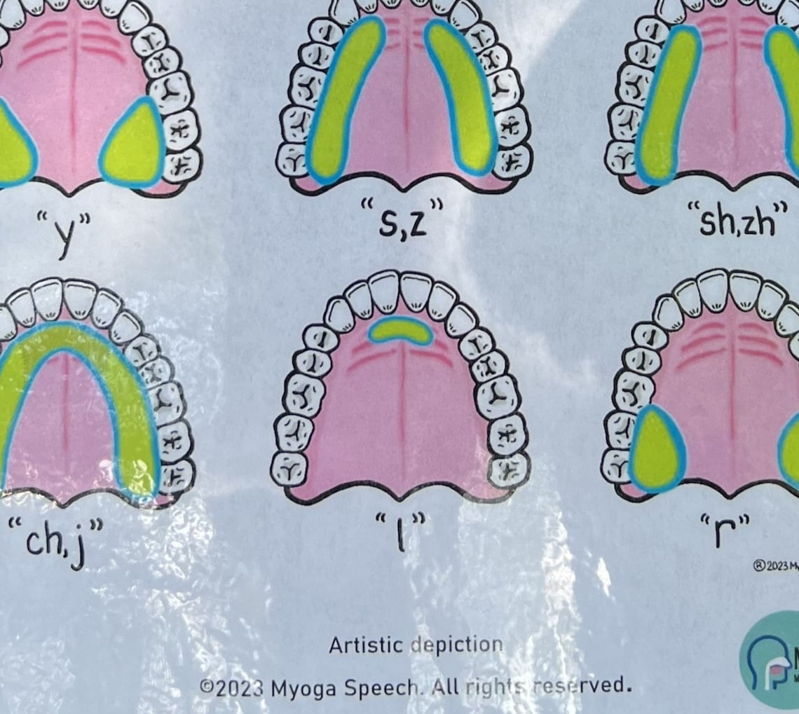 SOUNDS Palatogram (1 Page) of Tongue-palatal Consonants CHART (PDF ...