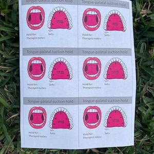 Tongue Myofunctional Therapy Exercise Cards Pdfs FREE Coloring Page ...