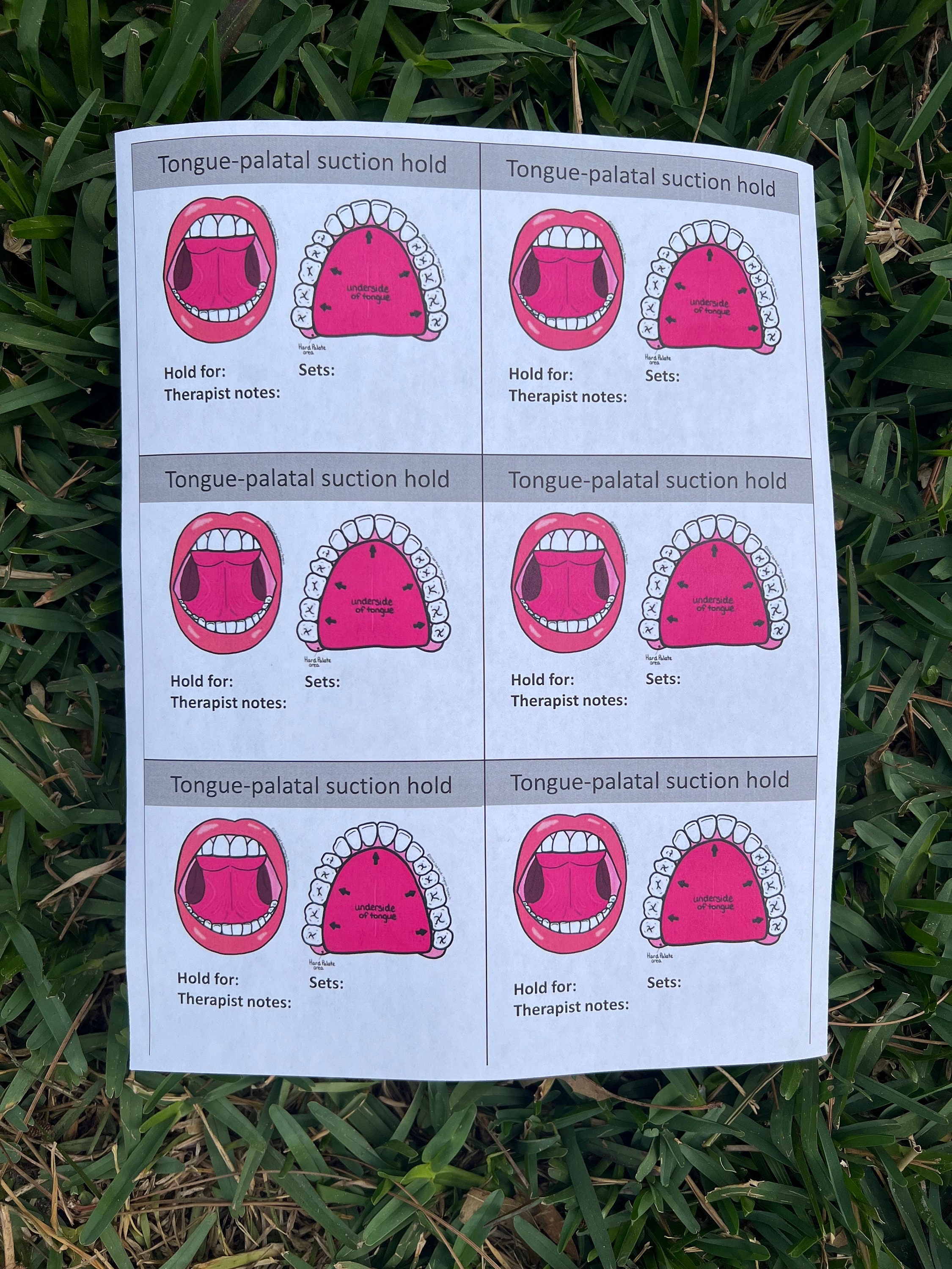 Tongue Myofunctional Therapy Exercise Cards Pdfs FREE Coloring Page ...