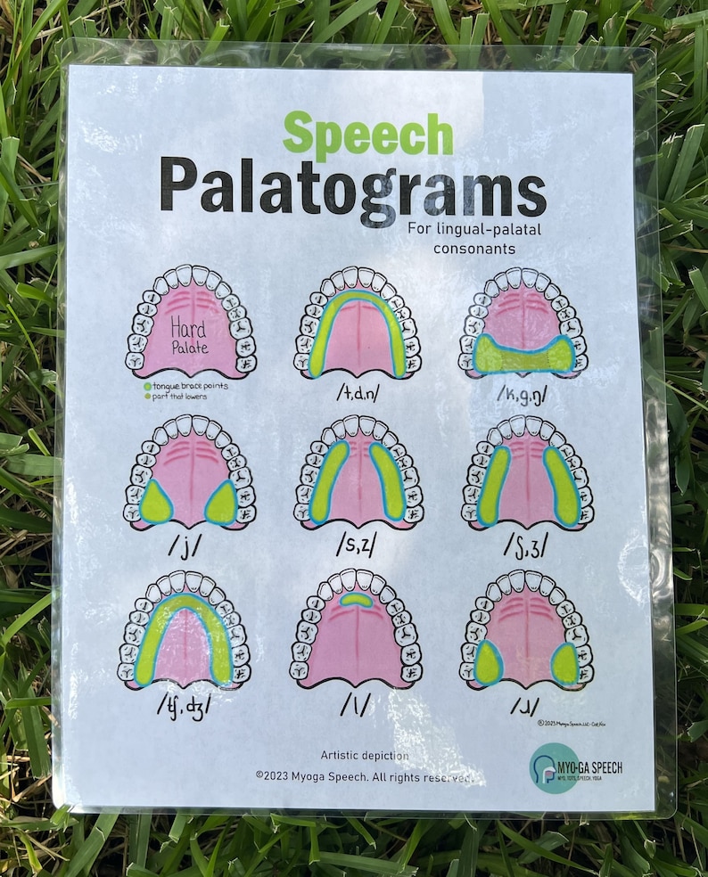 IPA Palatogram (1 Page) of Tongue-palatal Consonants CHART (PDF ...