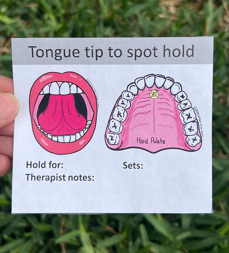 Tongue Myofunctional Therapy Exercise Cards Pdfs FREE Coloring Page ...