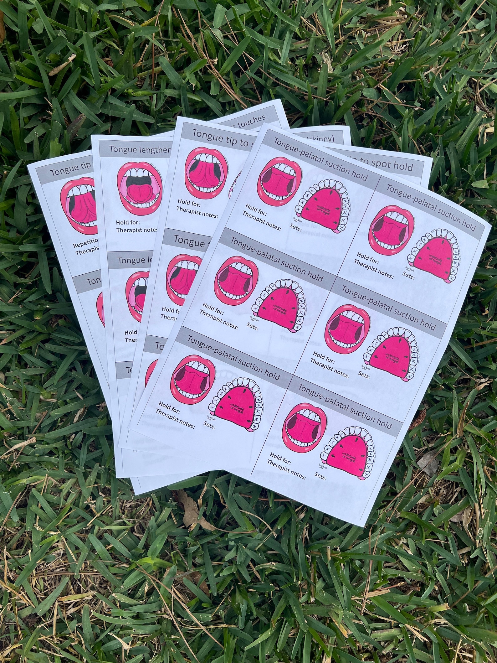 Tongue Myofunctional Therapy Exercise Cards Pdfs FREE Coloring Page ...