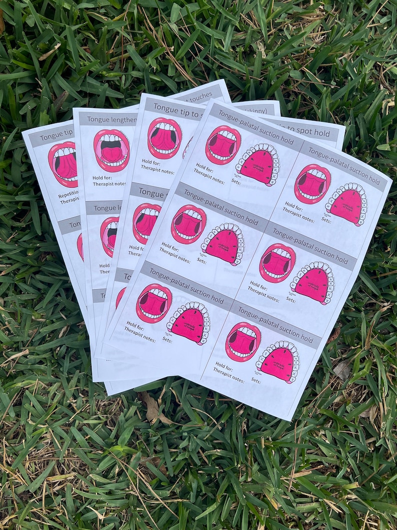 Tongue Myofunctional Therapy Exercise Cards Pdfs FREE Coloring Page ...