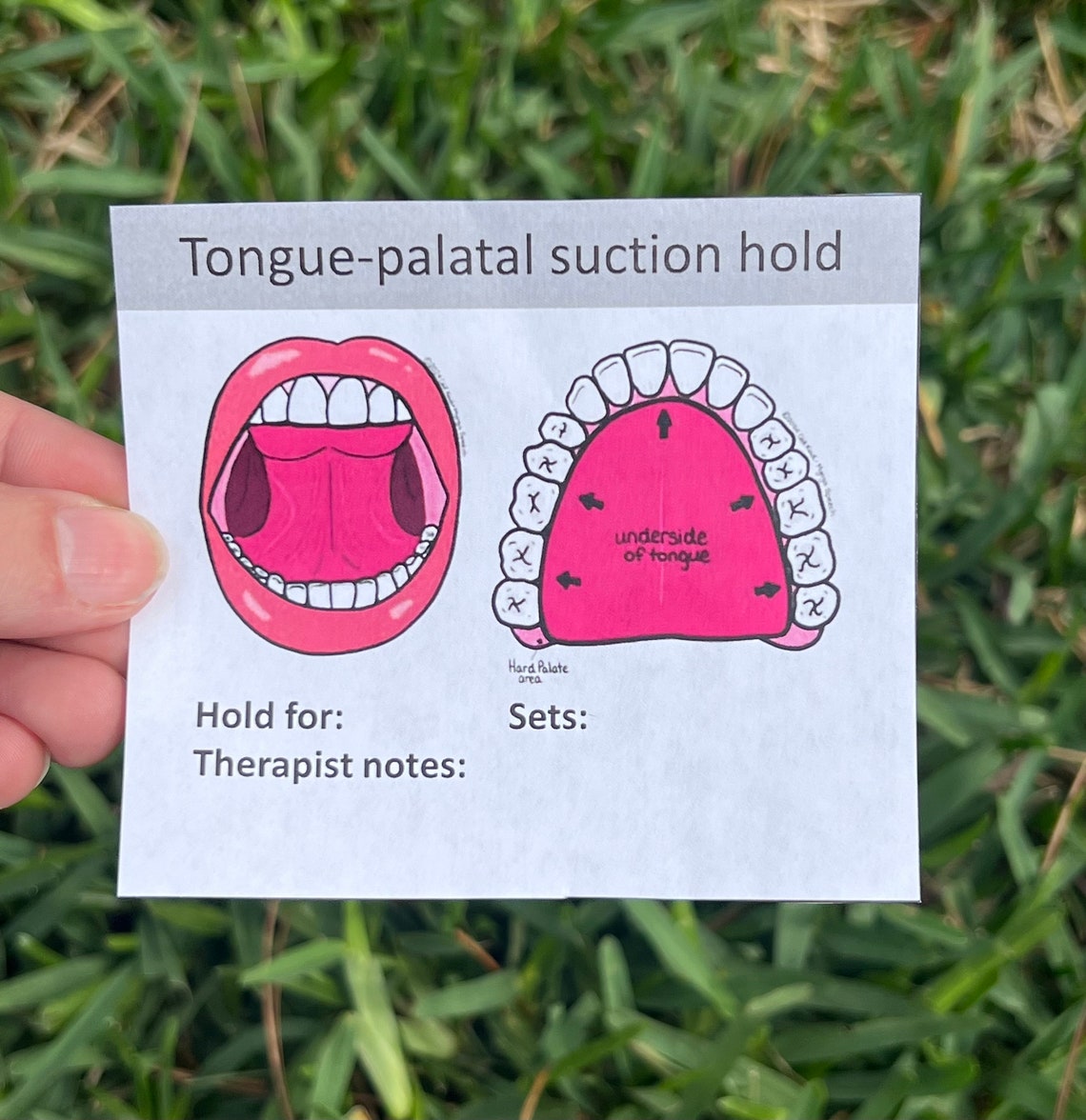 Tongue Myofunctional Therapy Exercise Cards Pdfs FREE Coloring Page ...