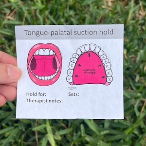 Tongue Myofunctional Therapy Exercise Cards Pdfs FREE Coloring Page ...