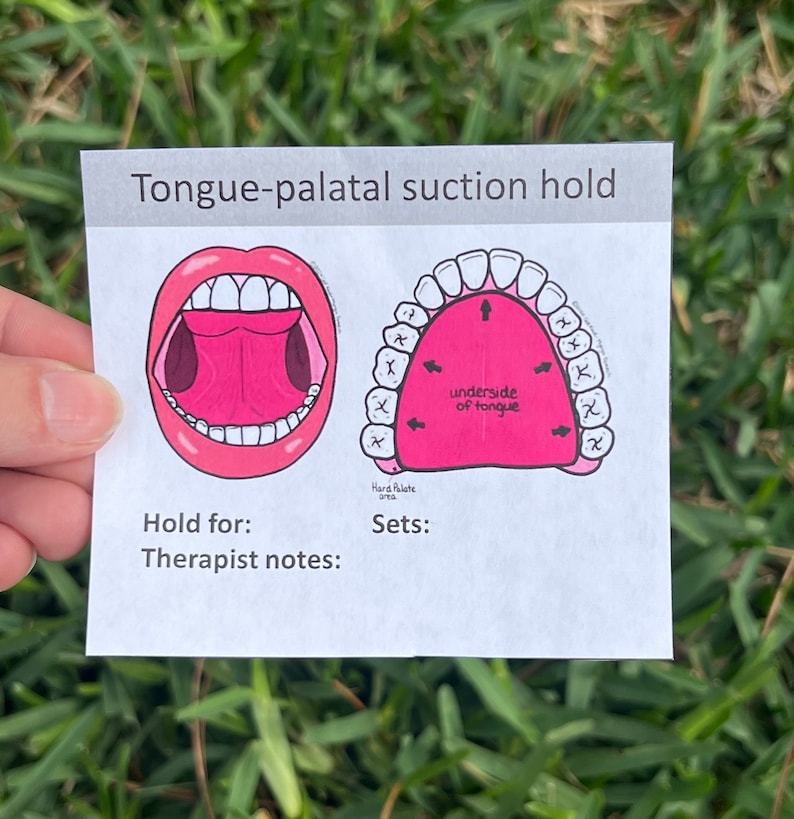 Tongue Myofunctional Therapy Exercise Cards Pdfs FREE Coloring Page ...