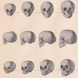 1900 SKULLS Print - Human Skulls Print - Human Anatomy Print ...