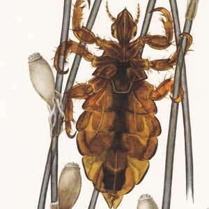 1960 HEAD LICE & Body Lice Print - Vintage Insect Print - Bugs ...