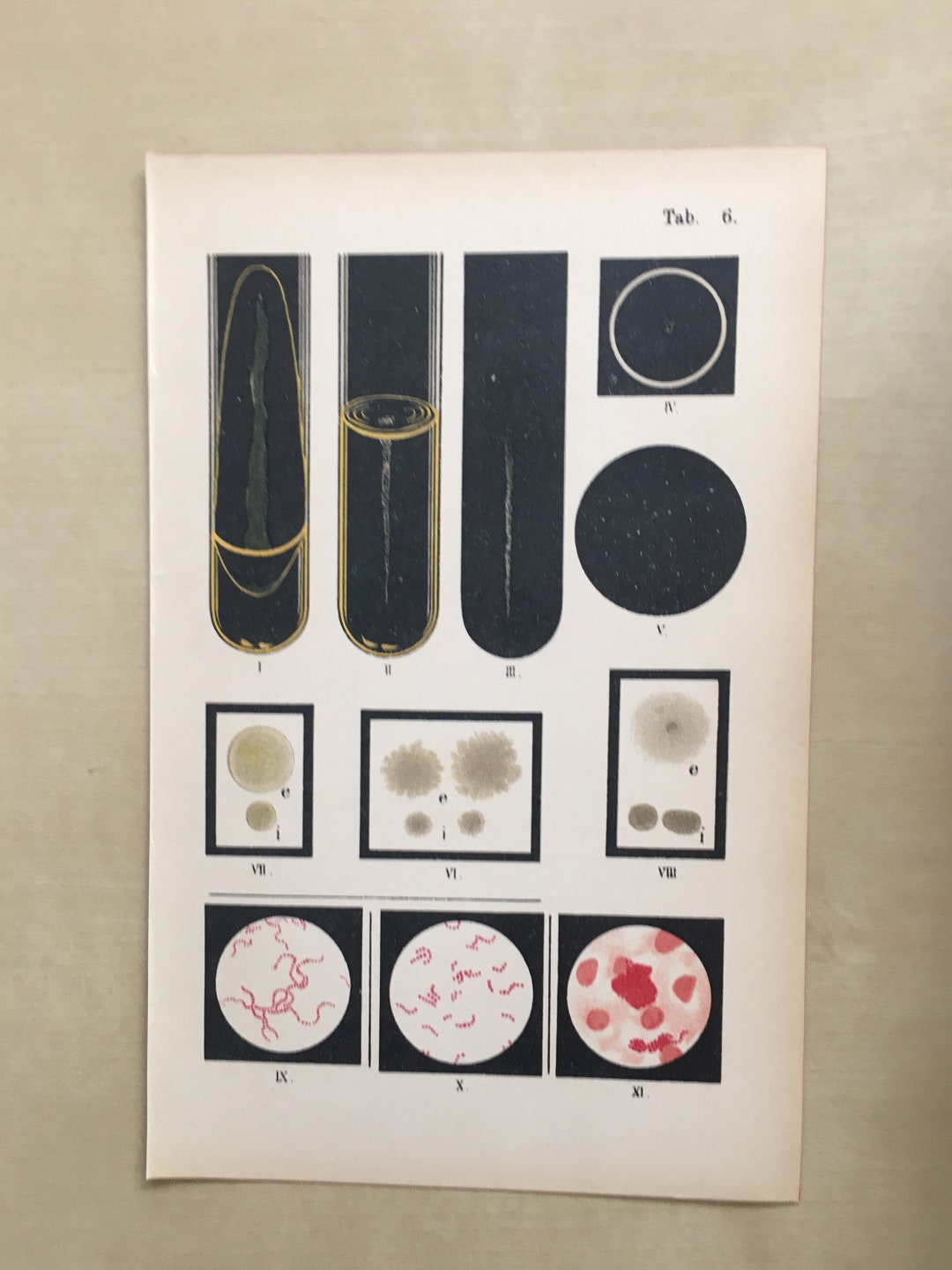 1897 BACTERIA Print - Streptococcus Pyogenes - Biologist Gift Idea ...