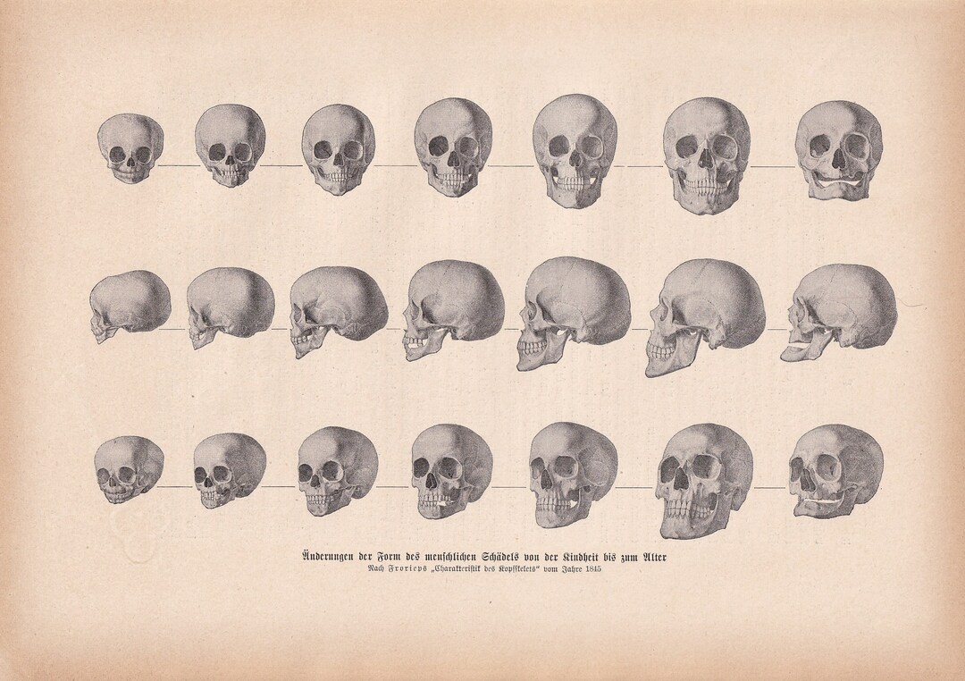 1900 SKULLS Print - Human Skulls Print - Human Anatomy Print ...