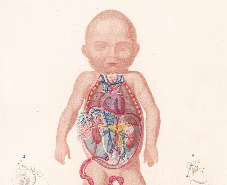 1861 FETUS ANATOMY Print - Hand-coloured Antique Print - Orbigny - Baby ...