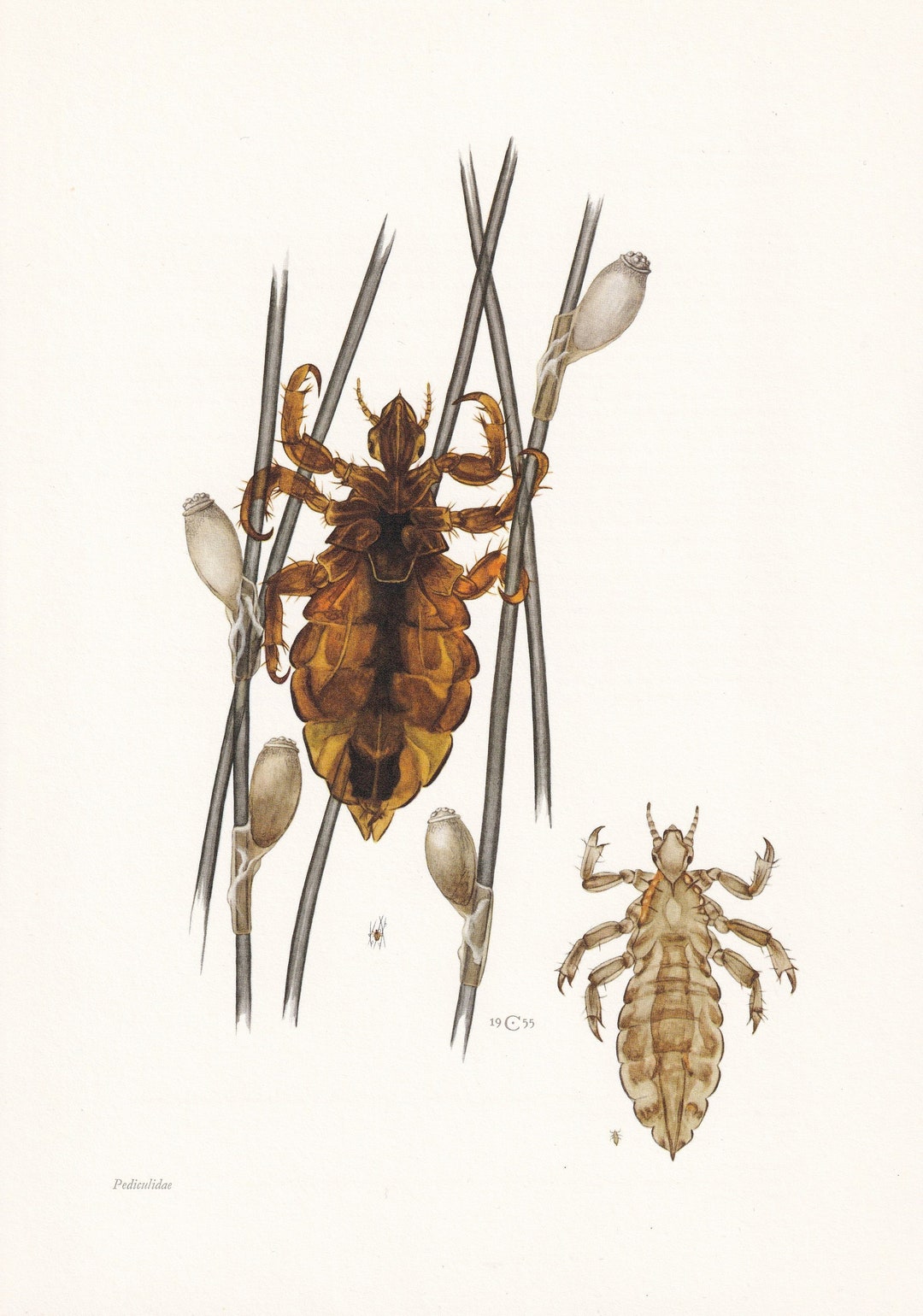 1960 HEAD LICE & Body Lice Print - Vintage Insect Print - Bugs ...