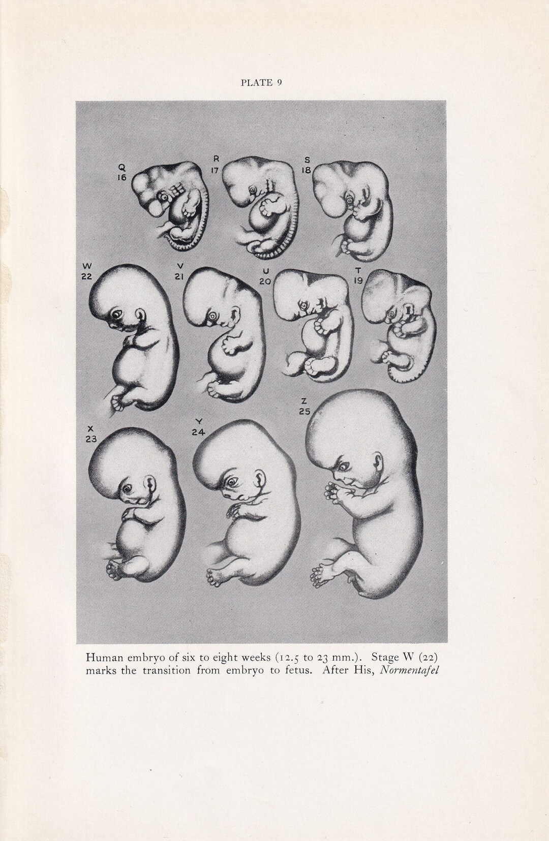 1934 HUMAN EMBRYO Print - Pregnancy Print - Original Vintage Print ...