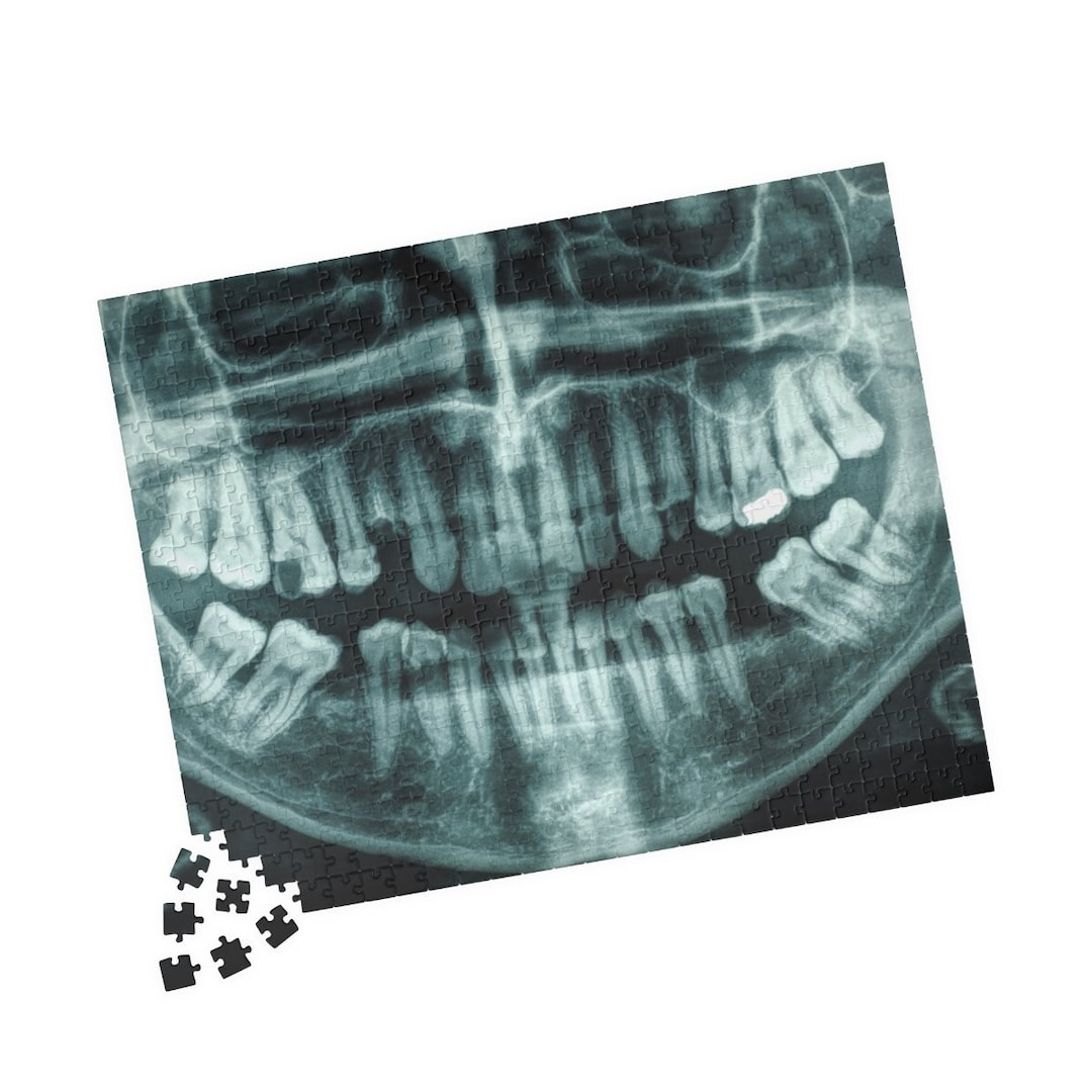 Dentist X-ray Jigsaw Puzzle, Impossible Puzzle, Wooden Pieces, Unique ...