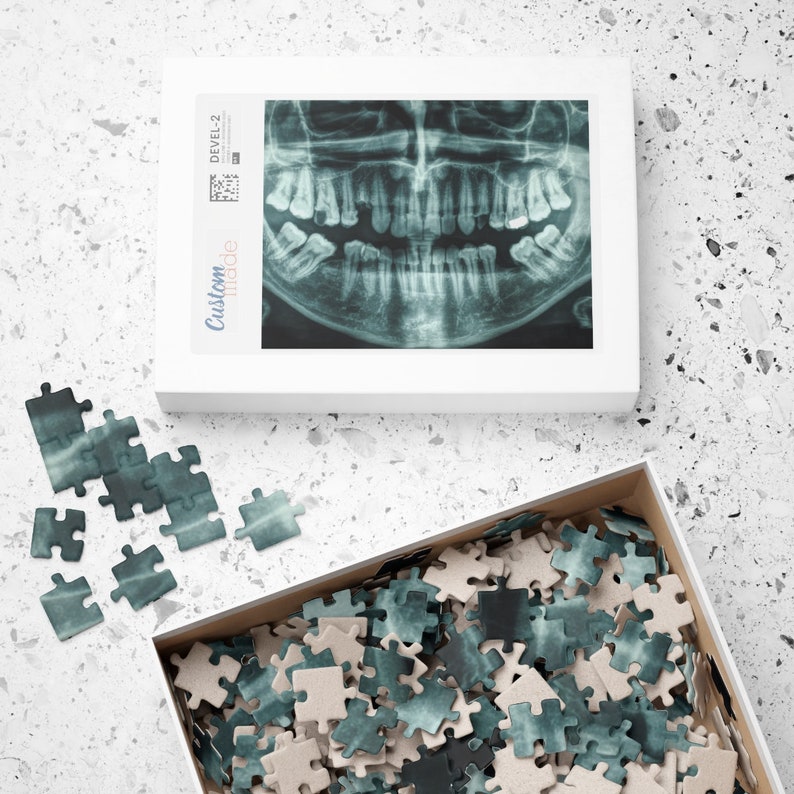 Dentist X-ray Jigsaw Puzzle, Impossible Puzzle, Wooden Pieces, Unique ...