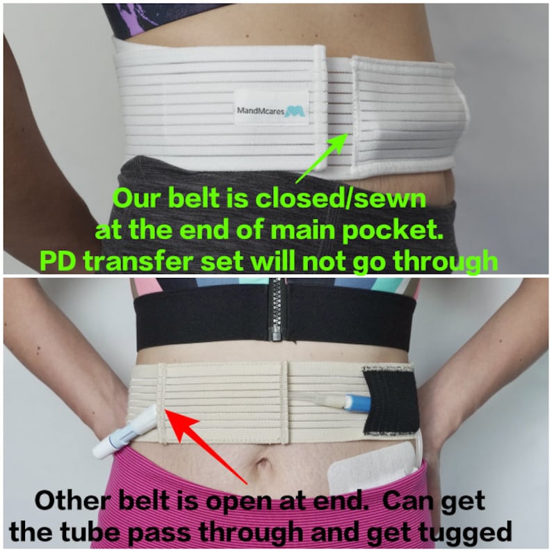 Peritoneal Dialysis Belt | PD Belt | Velcro Type - Etsy
