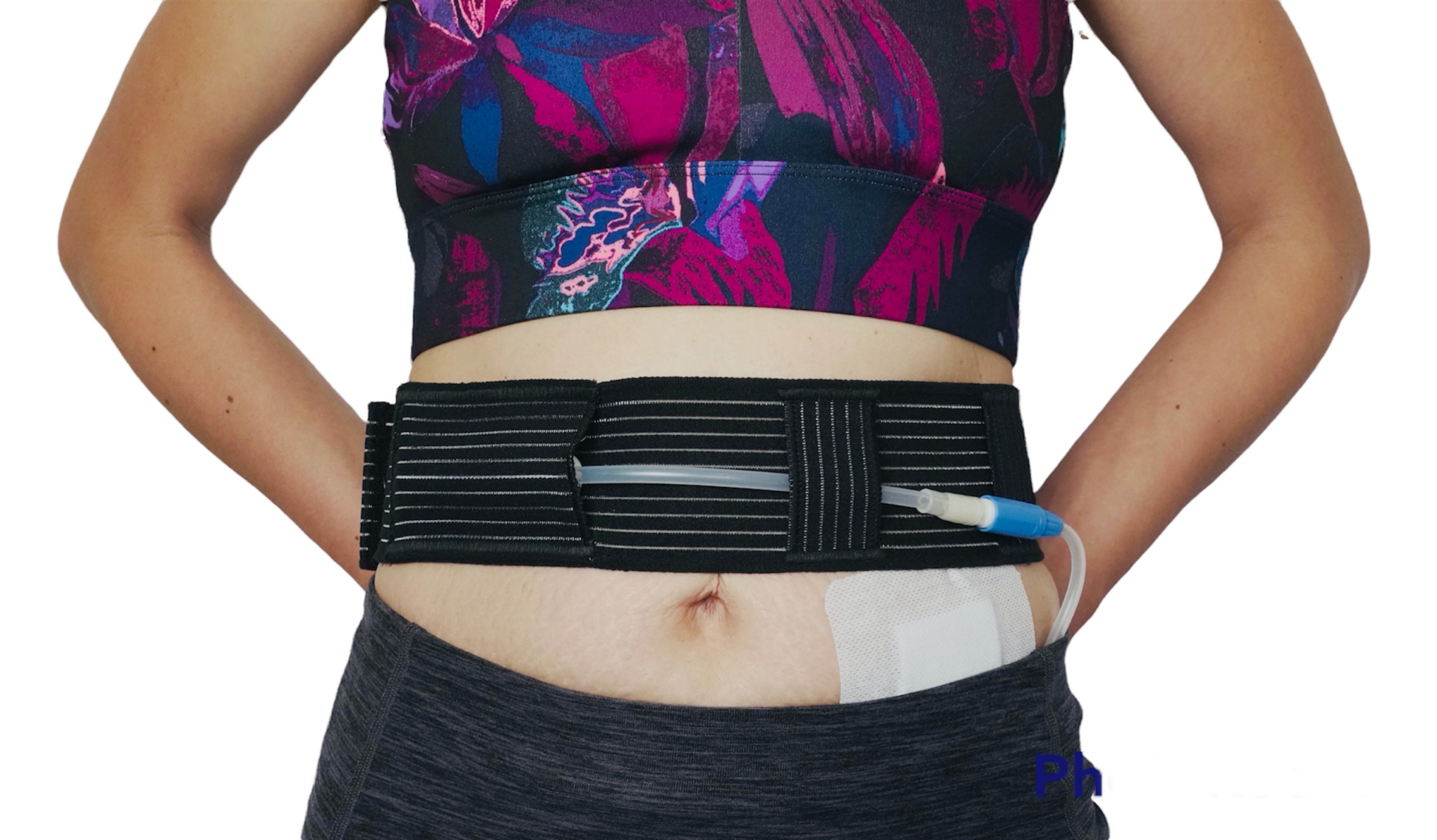 Peritoneal Dialysis Belt | PD Belt | Velcro Type - Etsy