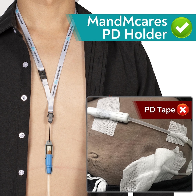 Peritoneal Dialysis Transfer Set Holder: Shower & Daily Wear ...