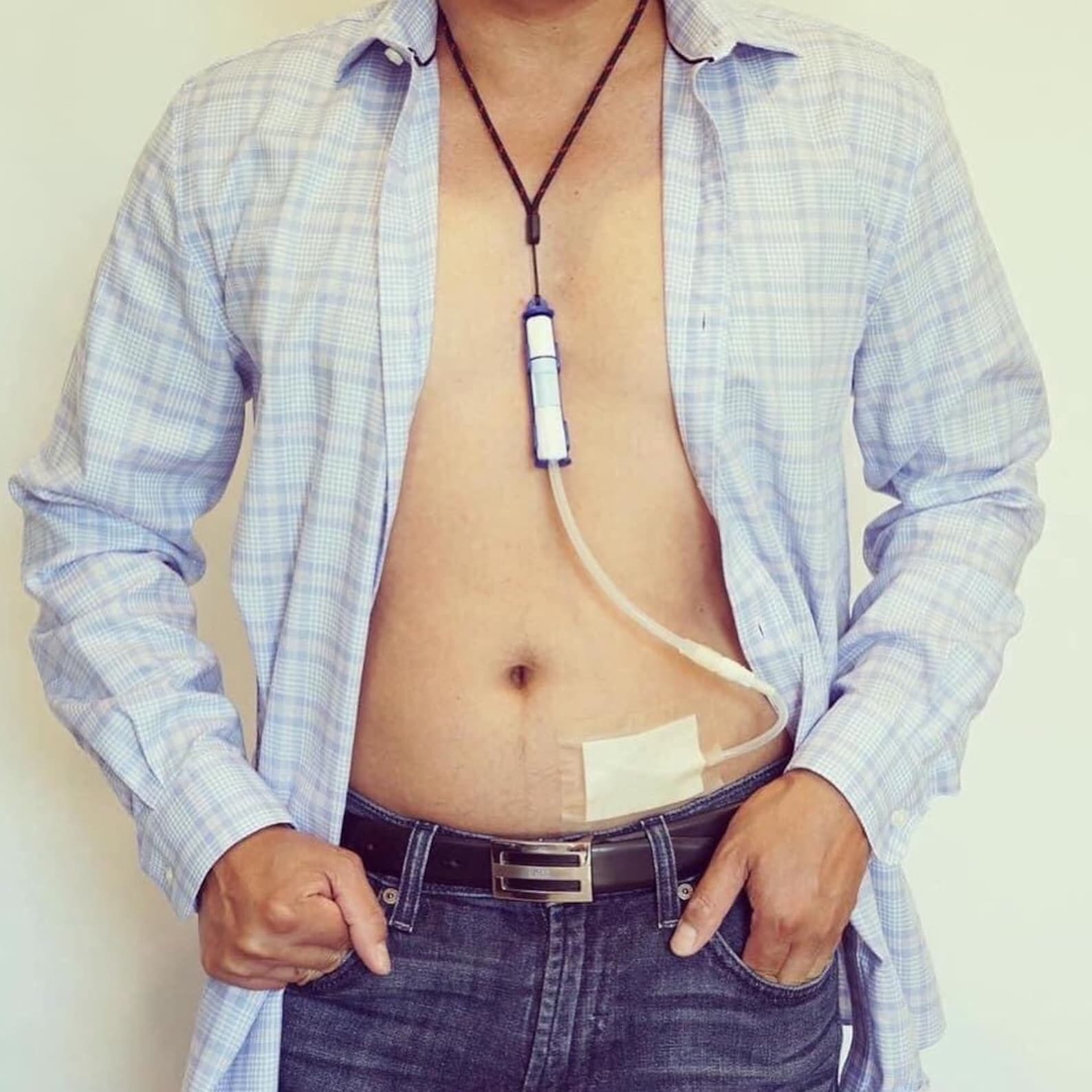 Baxter PD Transfer Set Holder: Adjustable Peritoneal Dialysis Necklace ...