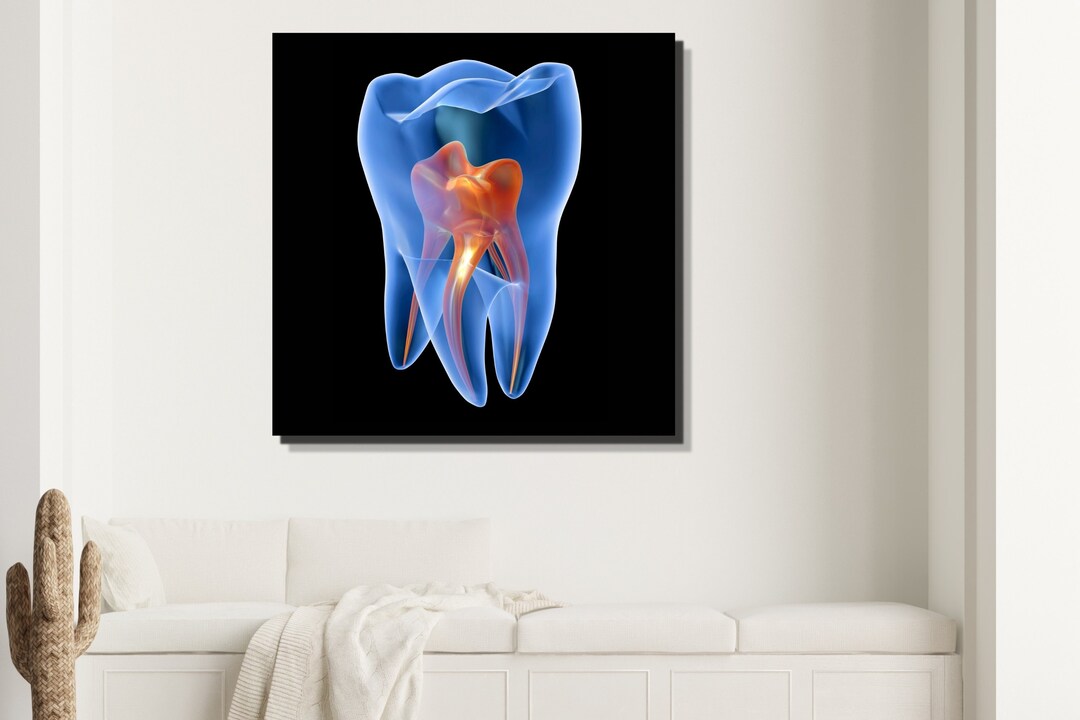 X-ray Molar Tooth Canvas|dental Clinic Decor|gift for Dentist|abstract ...