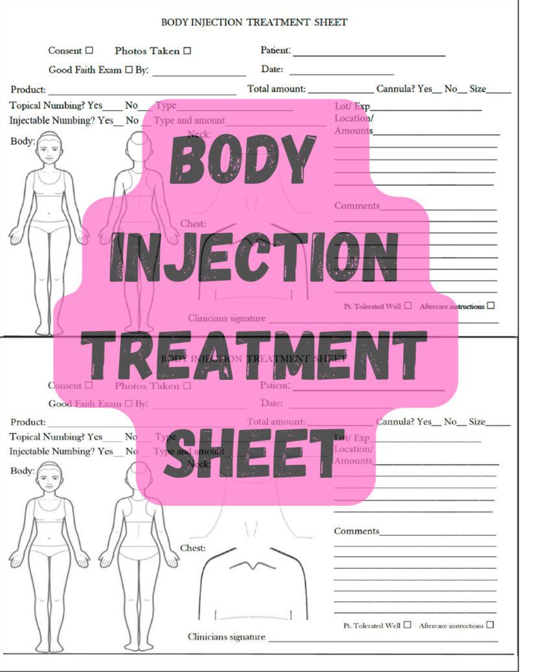 Body Injection Treatment Sheet- Sculptra, Radiesse, Digital Download ...