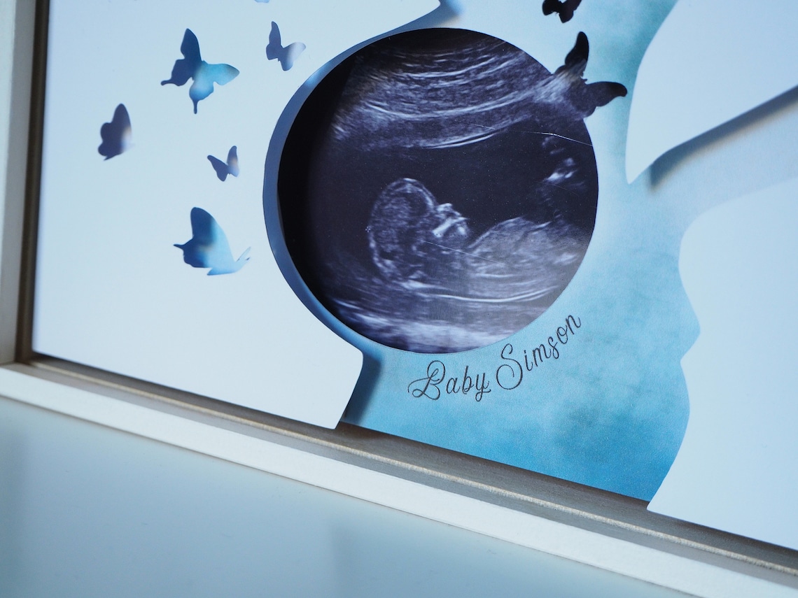 Baby Ultrasound Shadow Box | Ultrasound Picture Frame | 3D Baby Scan ...