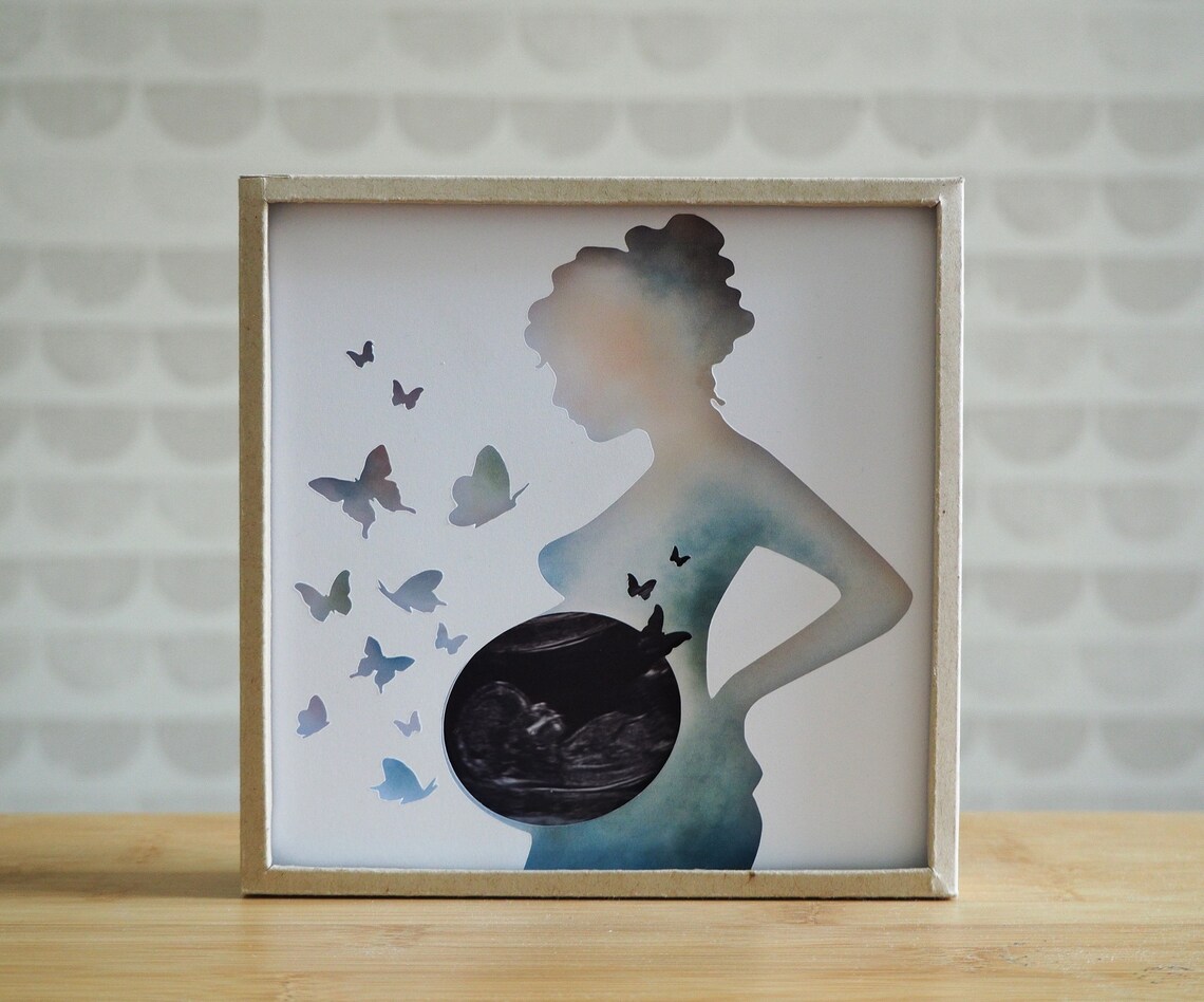 Baby Ultrasound Shadow Box | Ultrasound Picture Frame | 3D Baby Scan ...