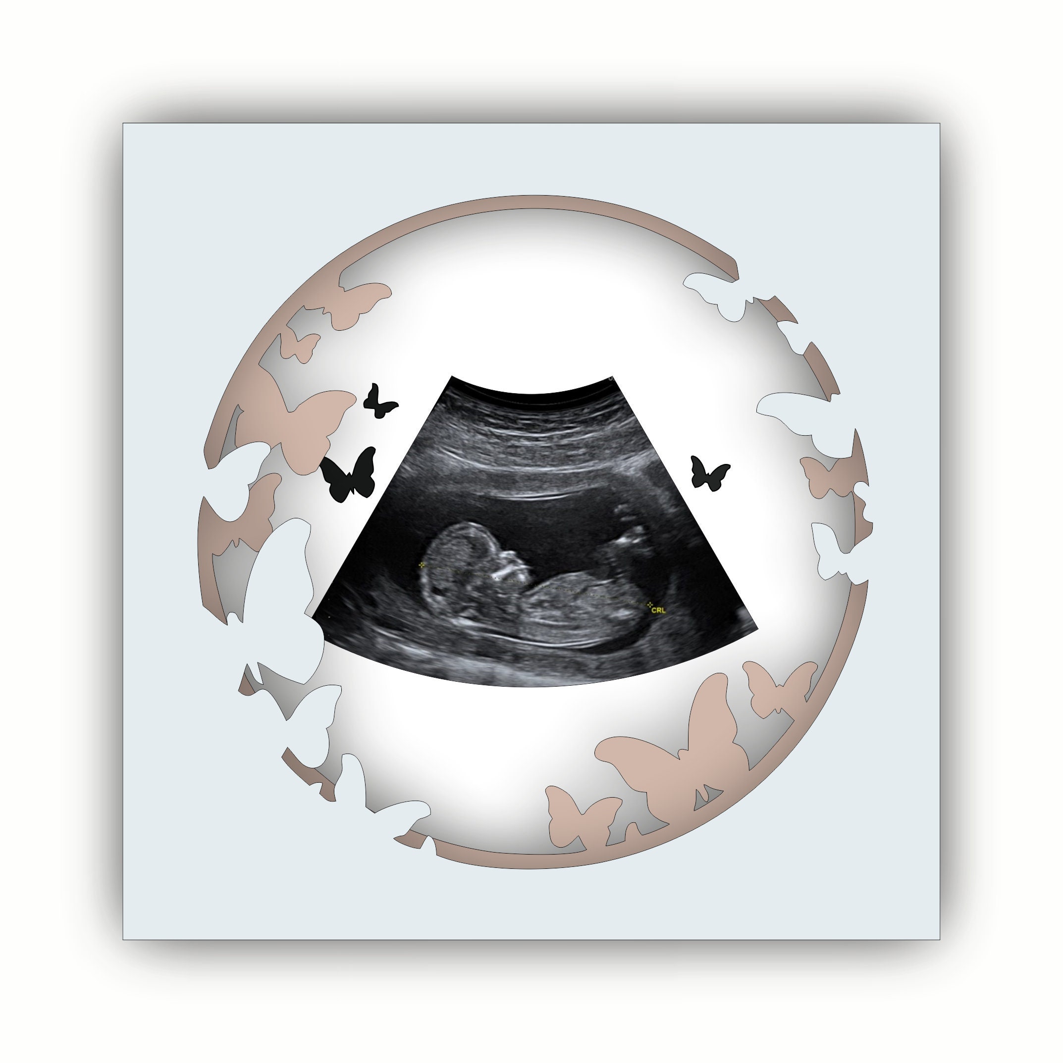 Baby Scan Photo Frame Template| Baby Ultrasound Picture Frame| Baby ...
