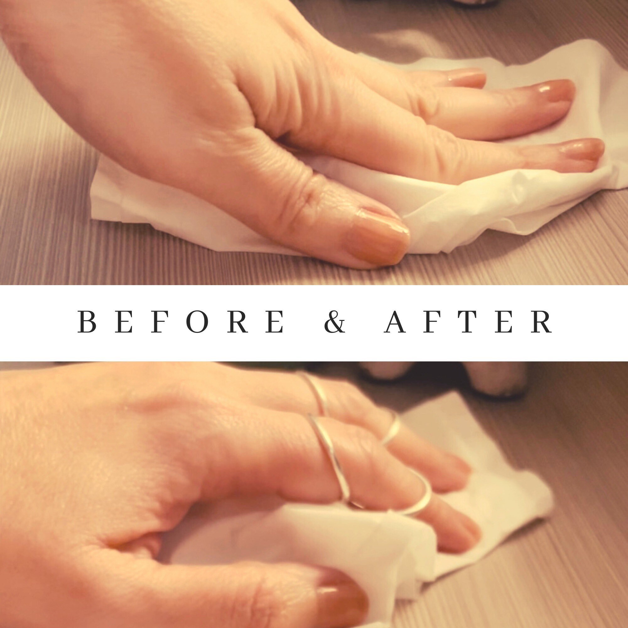 EDS Swan Neck Splint Made by a Hand Therapist - Etsy