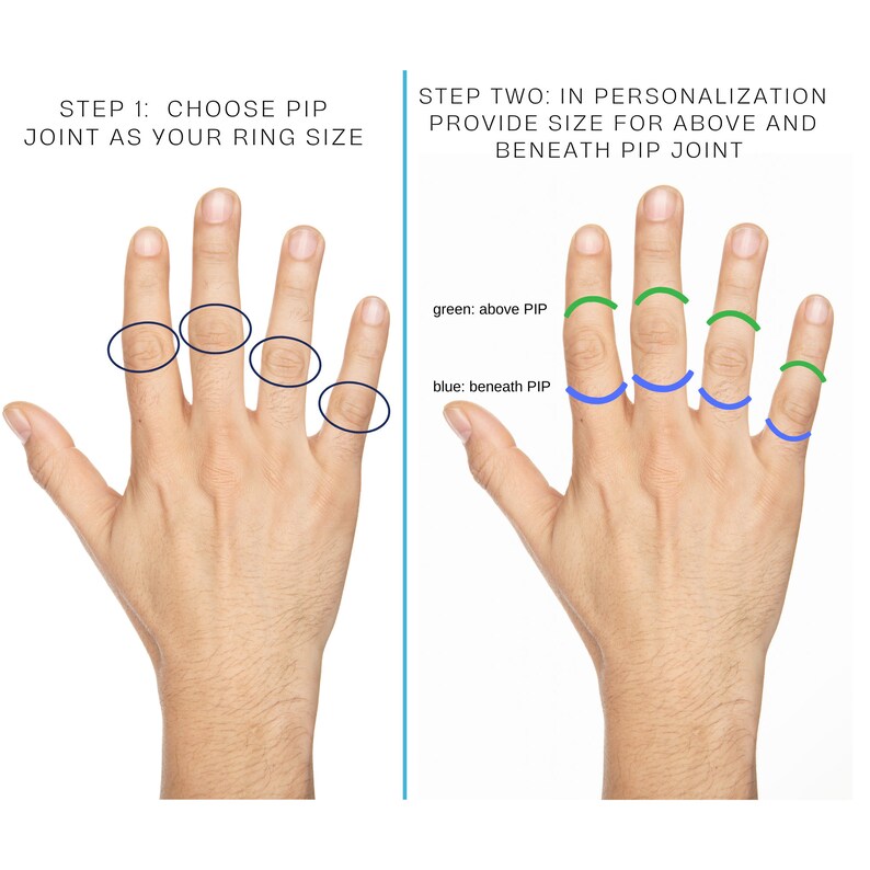 EDS Swan Neck Splint Made by a Hand Therapist - Etsy