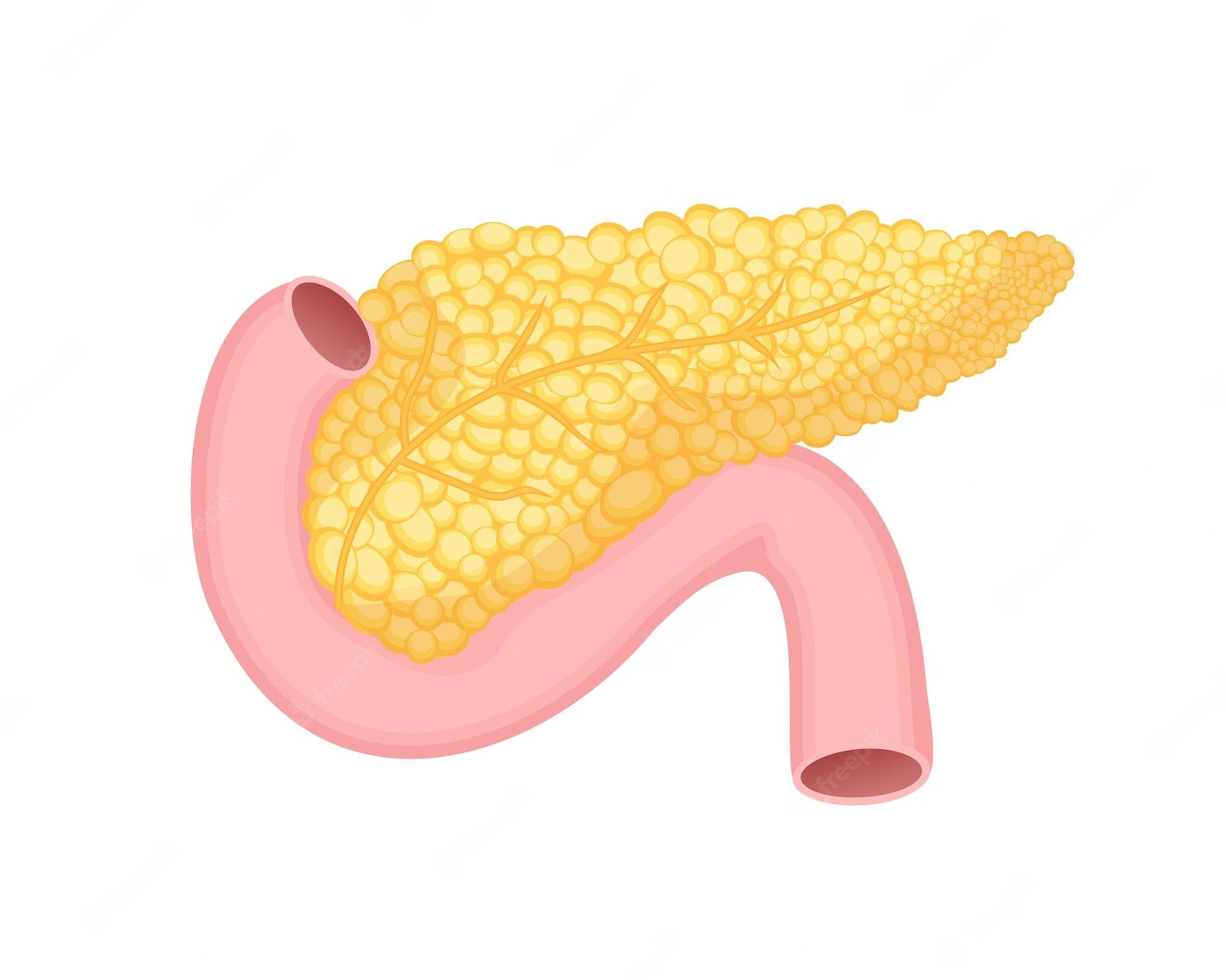 Clin Path: Pancreas and GI - Etsy