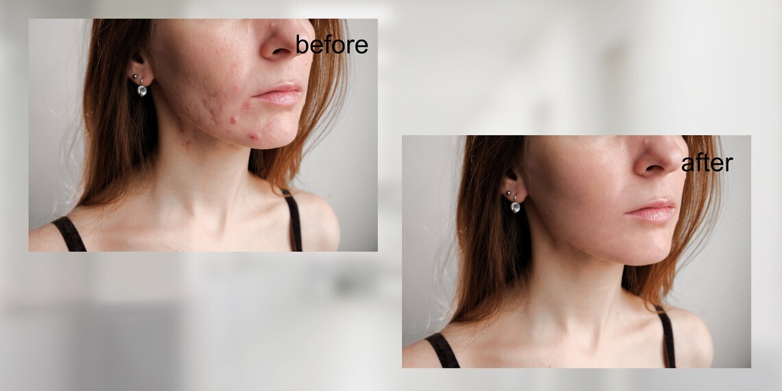 Photo Retouching Service, Photoshop Editing, Custom Photo Editing, Face ...