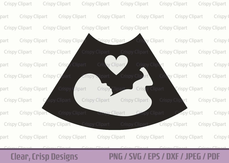 Ultrasound Image SVG Pregnancy Announcement Vector Fetus Image Cut File ...