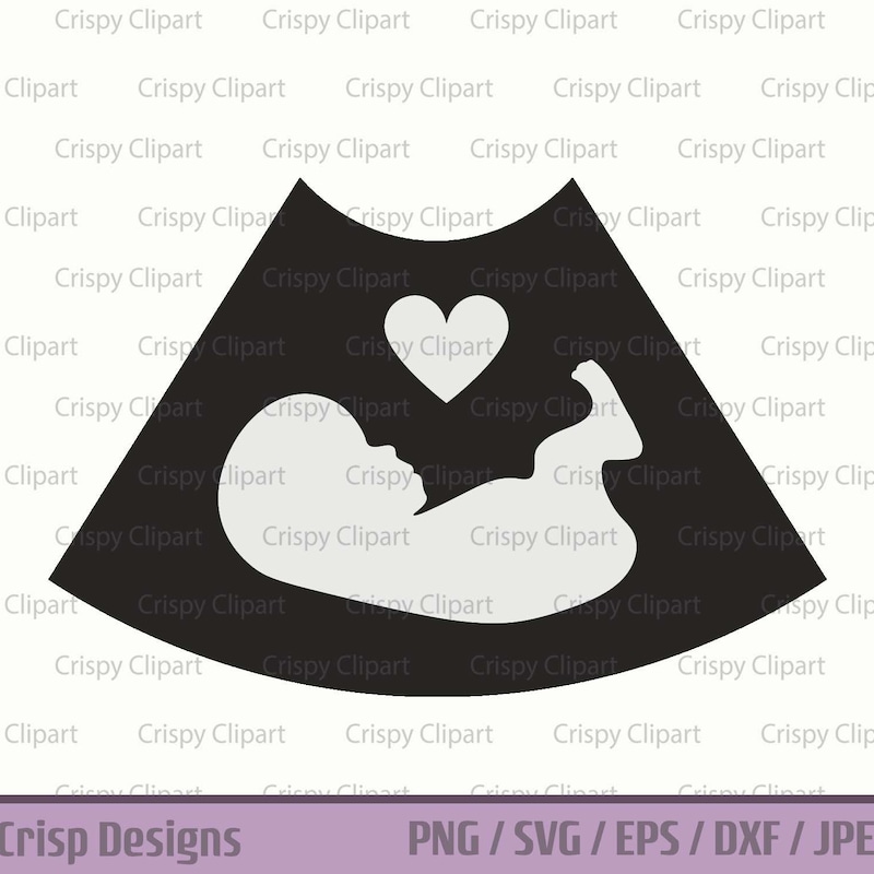 Baby Ultrasound Animated - Etsy