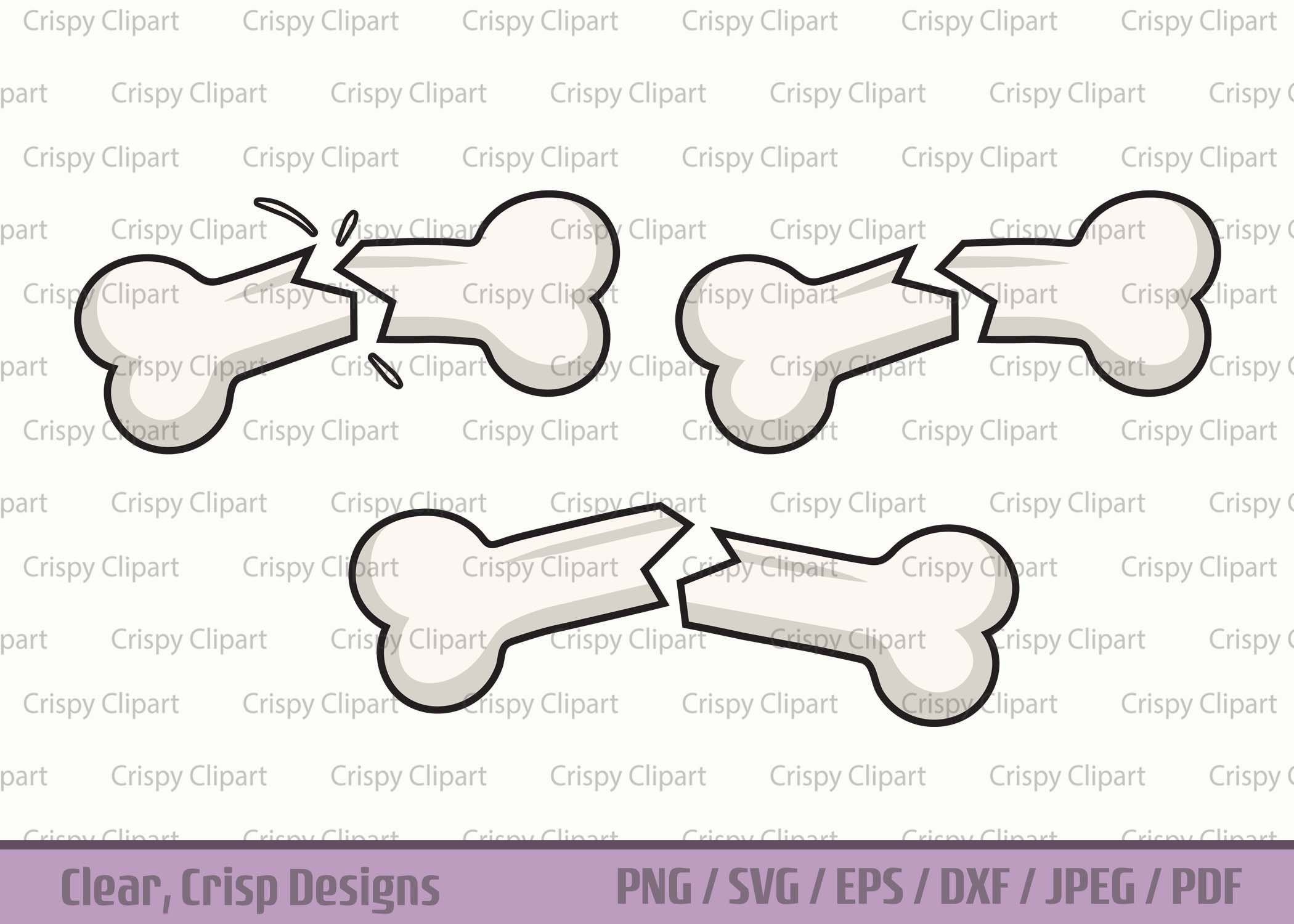 Broken Bone SVG, Snapped Bone Clipart, Bone Vector Art Graphic, Bone ...