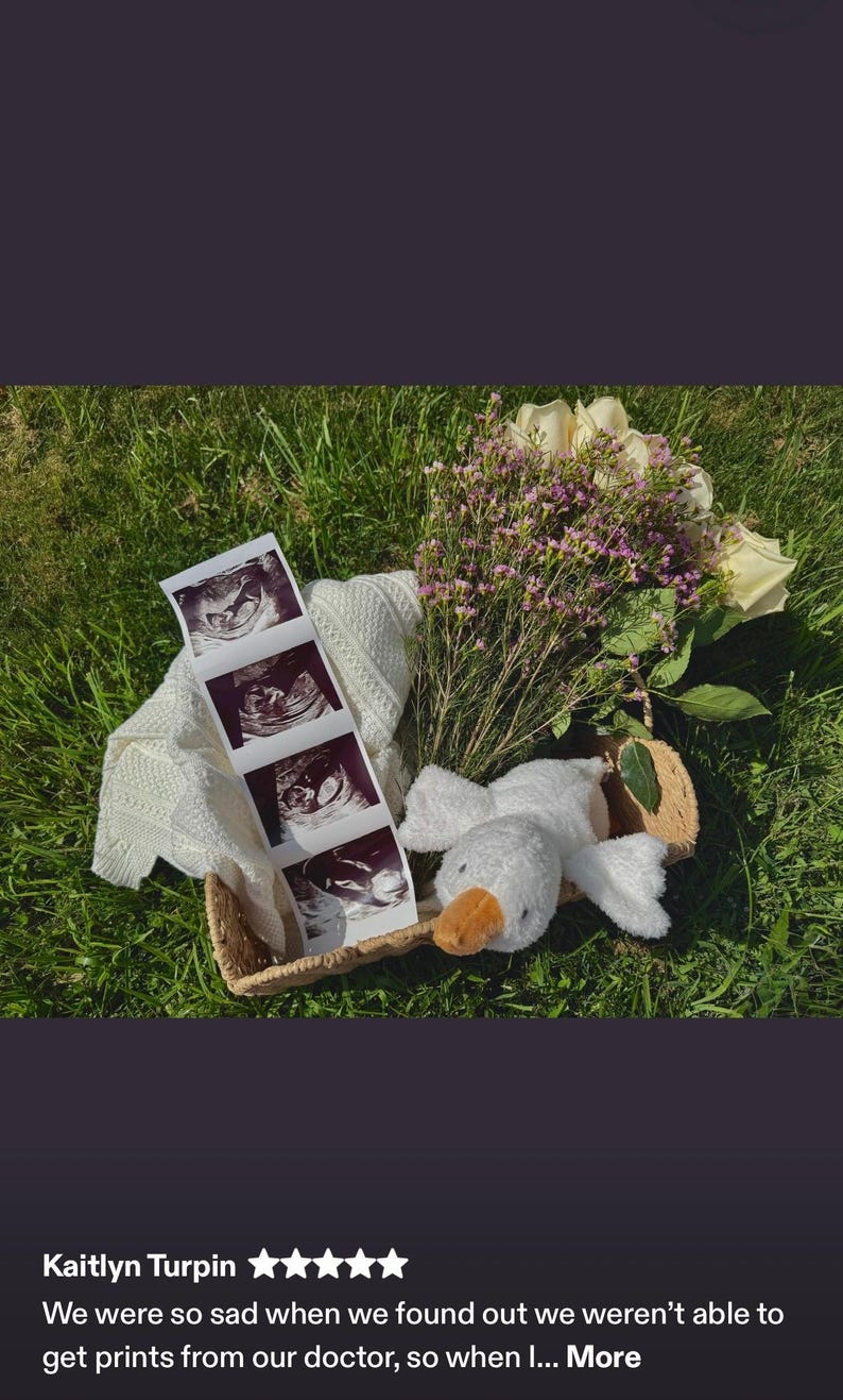 Traditional Ultrasound Image Strip: Ultrasound Prints - Etsy