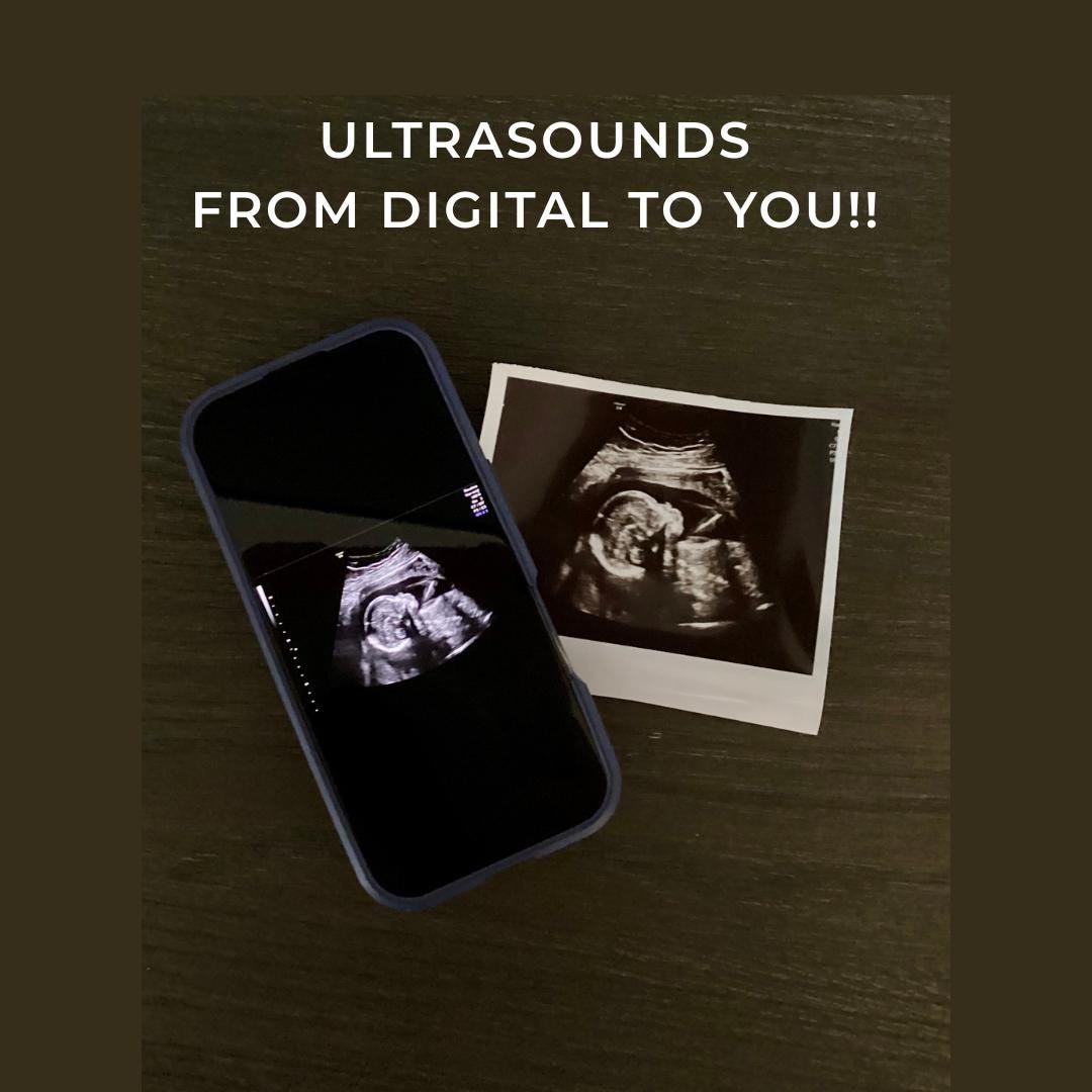 Traditional Ultrasound Image Strip: Ultrasound Prints - Etsy