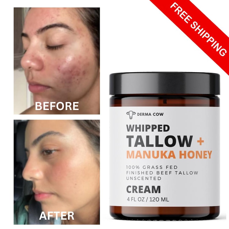 Tallow + Manuka Honey Cream, Grass Fed Beef, Cream for Face and Body ...