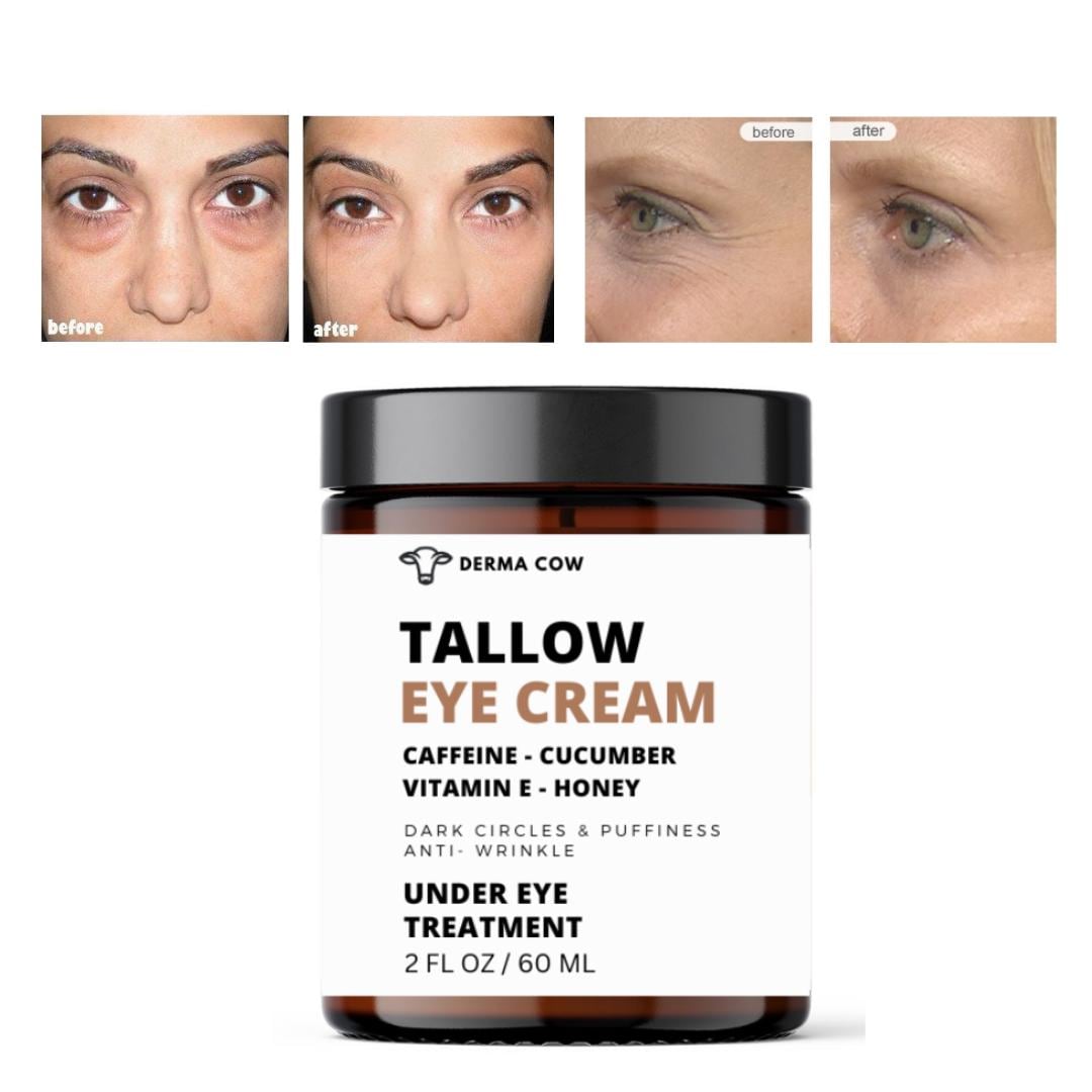 Tallow Eye Cream Infused With Caffeine, Honey, Vitamin E and Cucumber ...