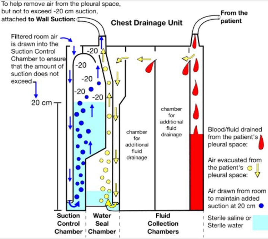 Chest Tubes (NCLEX) - Etsy