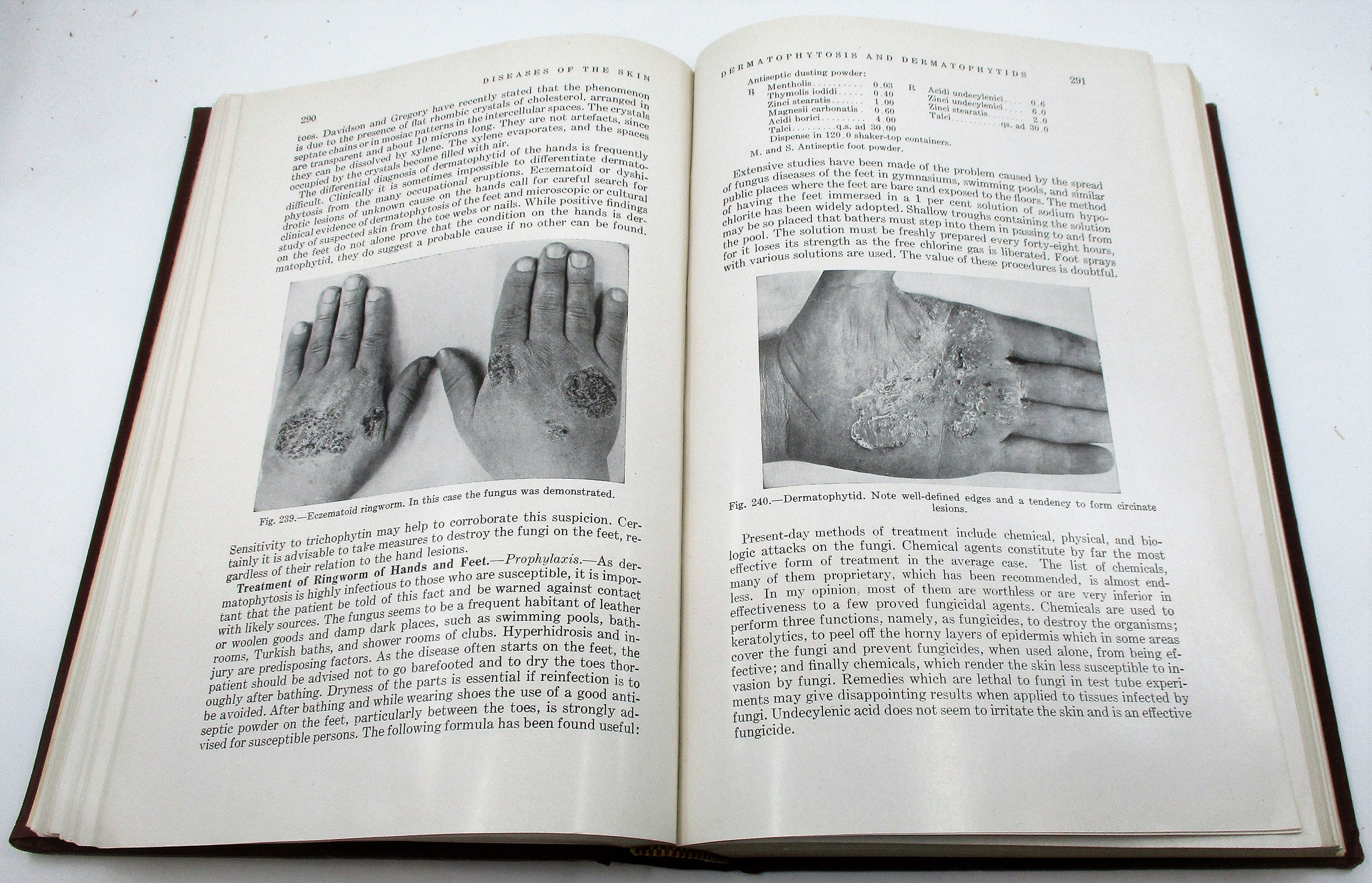 1946 Diseases of the Skin, Vintage Dermatology Medicine Book, Skin ...