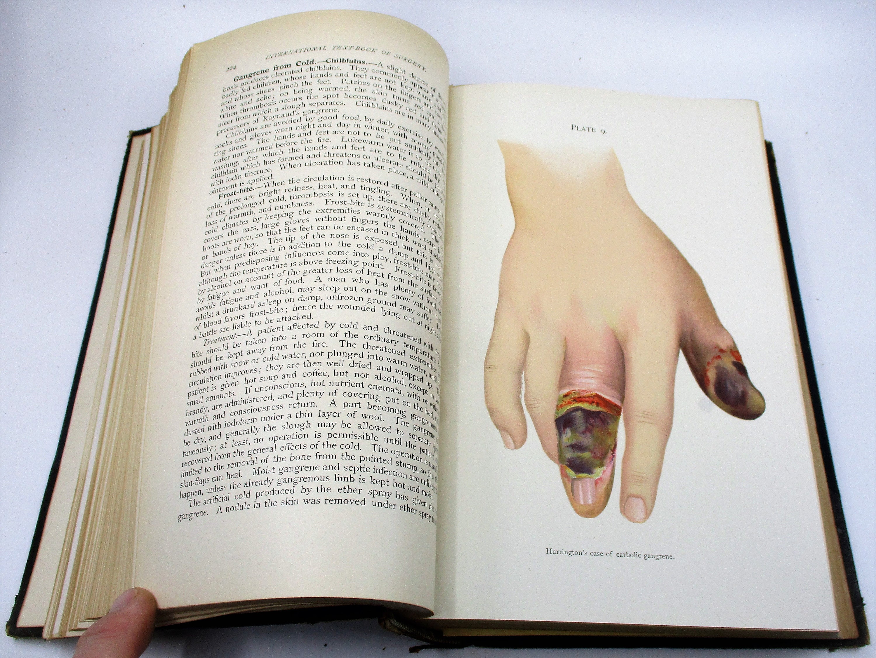 1900 Surgery International Textbook of Surgery Old Anatomy - Etsy