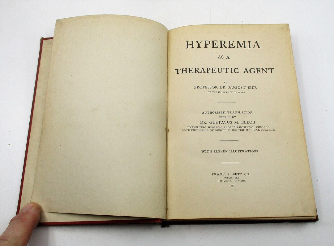 1913 Hyperemia as a Therapeutic Agent, Alternative Medicine Book ...