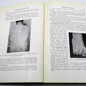 1937 Diseases of the Skin, Vintage Dermatology Medicine Book, Skin ...