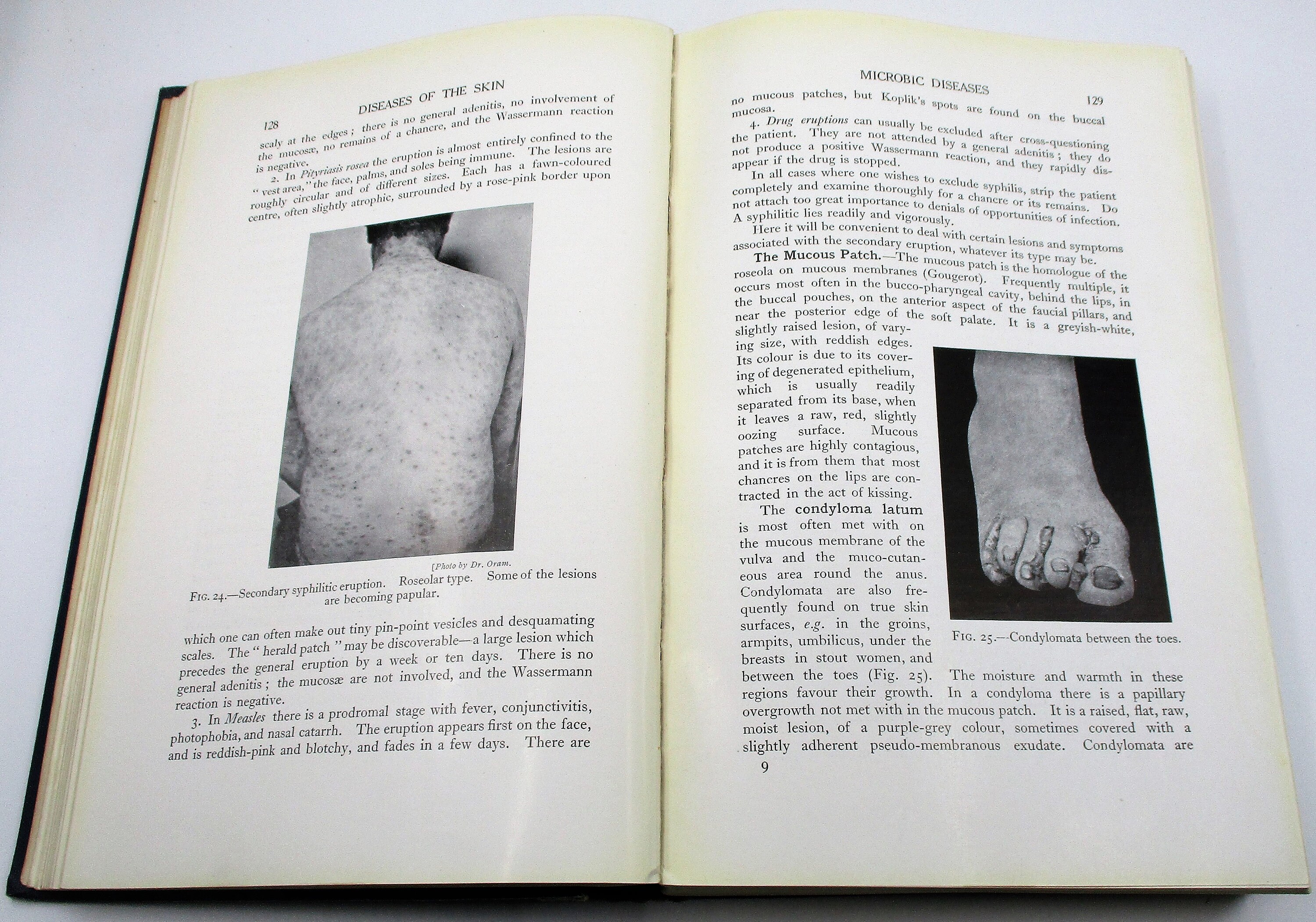 1937 Dermatology, Diseases of the Skin, Therapeutics: Vintage Medical ...