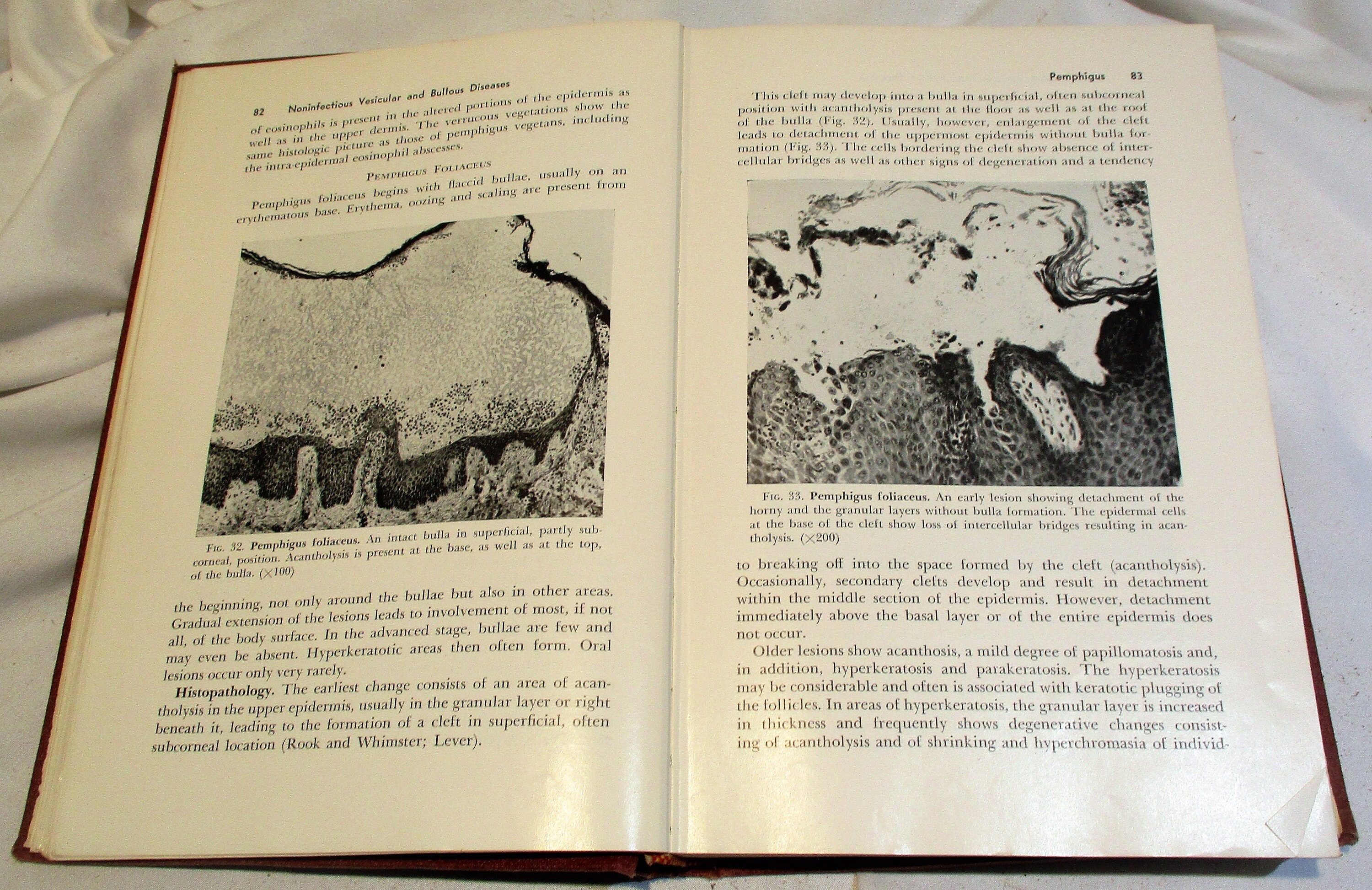 1954 Histopathology of the Skin, Vintage Dermatology Medicine Book ...