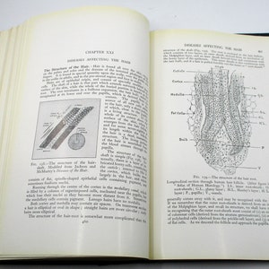 1937 Diseases of the Skin, Vintage Dermatology Medicine Book, Skin ...