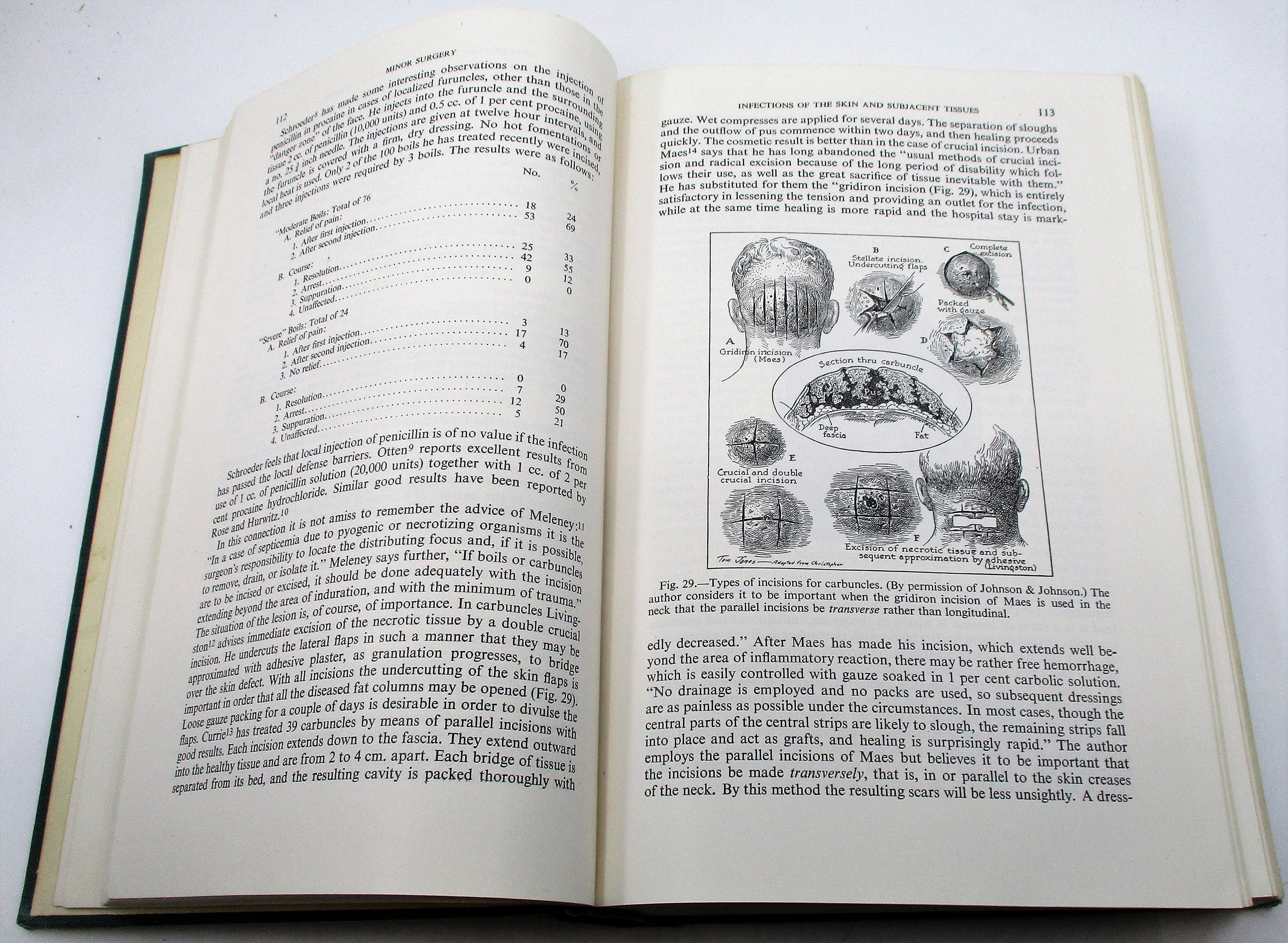 1948 Minor Surgery, Vintage Medicine Textbook, Medical School Textbook ...