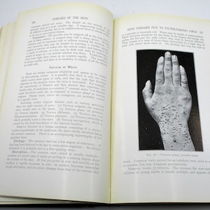 1937 Diseases of the Skin, Vintage Dermatology Medicine Book, Skin ...
