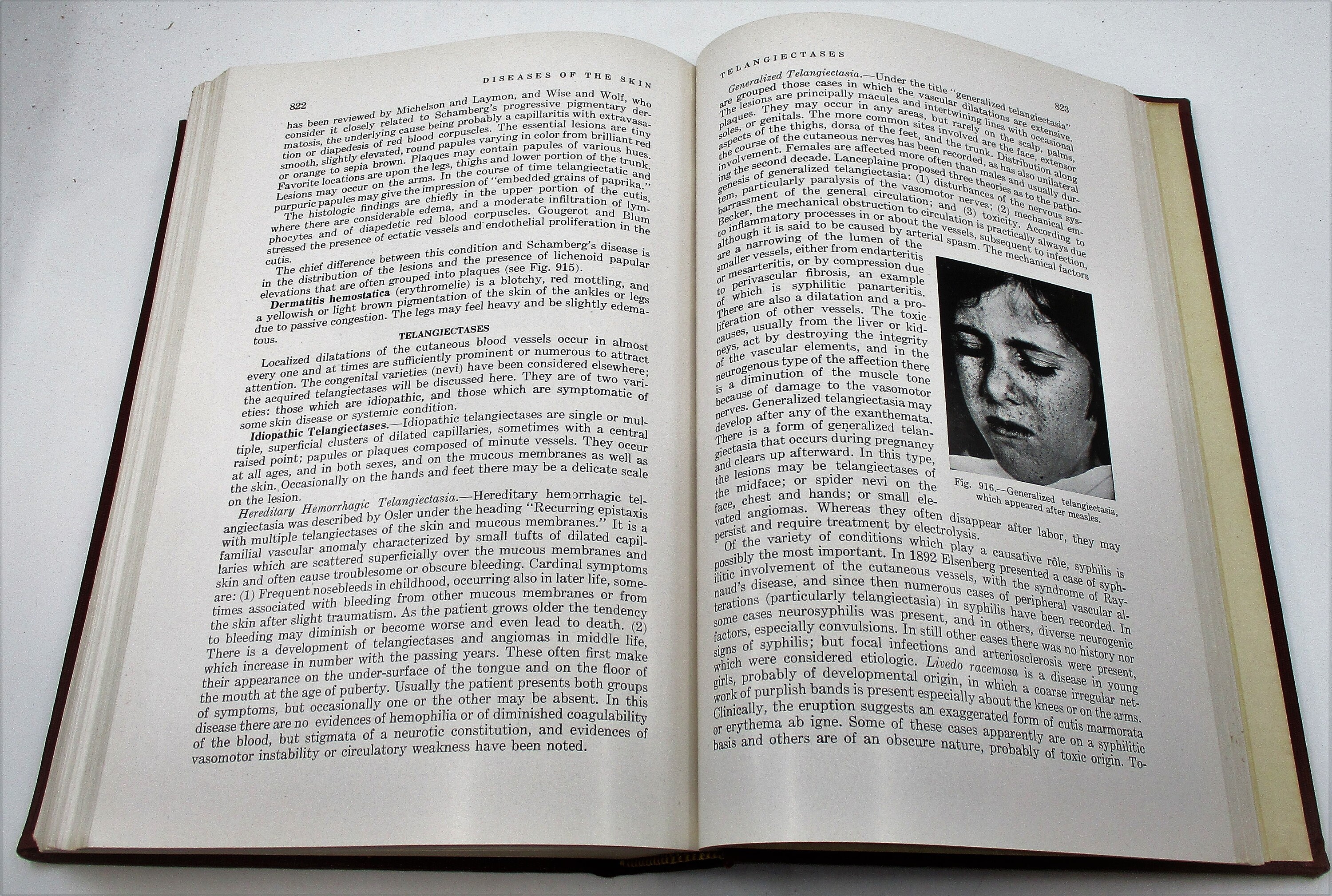 1946 Diseases of the Skin, Vintage Dermatology Medicine Book, Skin ...